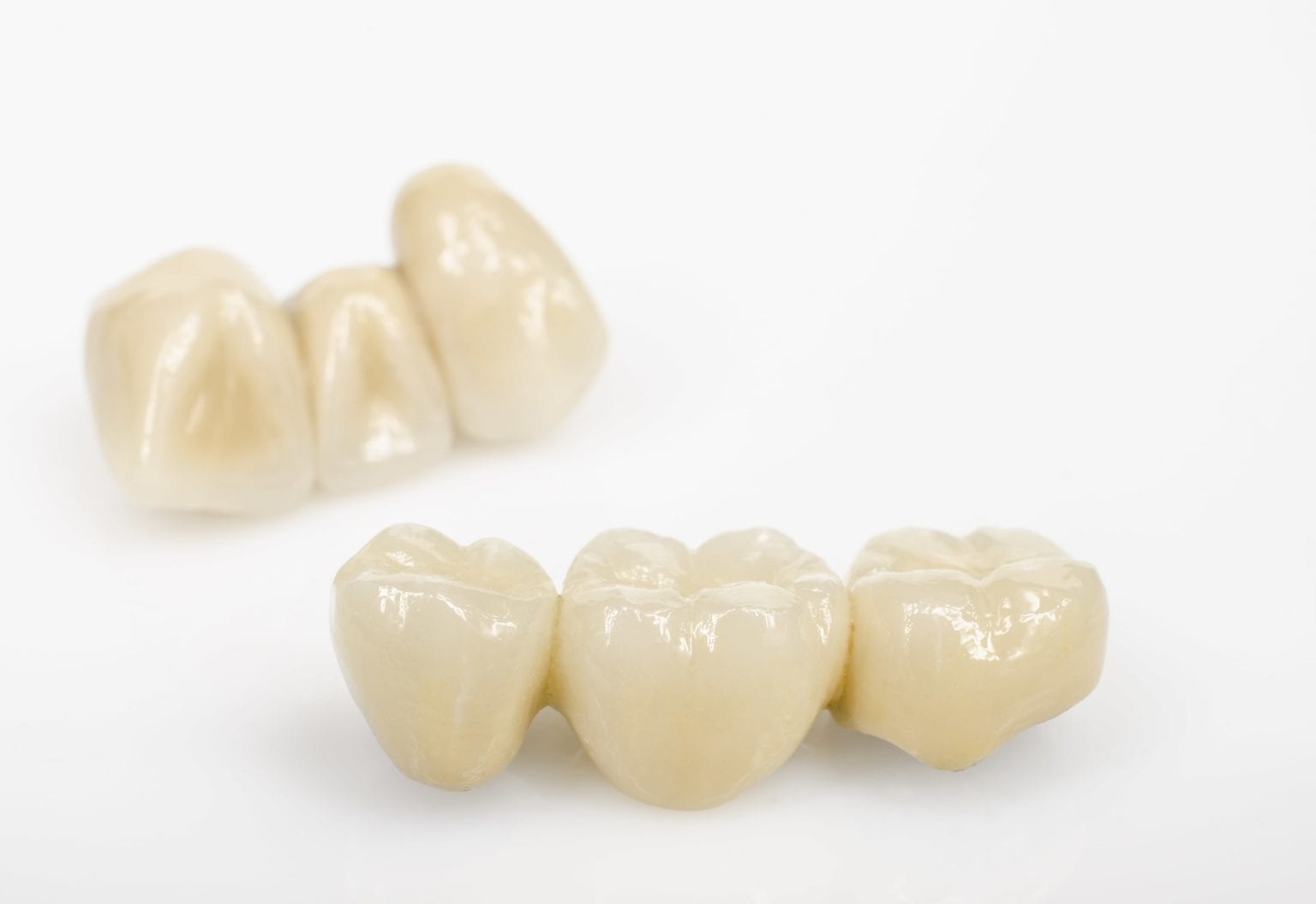 Explore Different Types of Cosmetic Dental Crowns